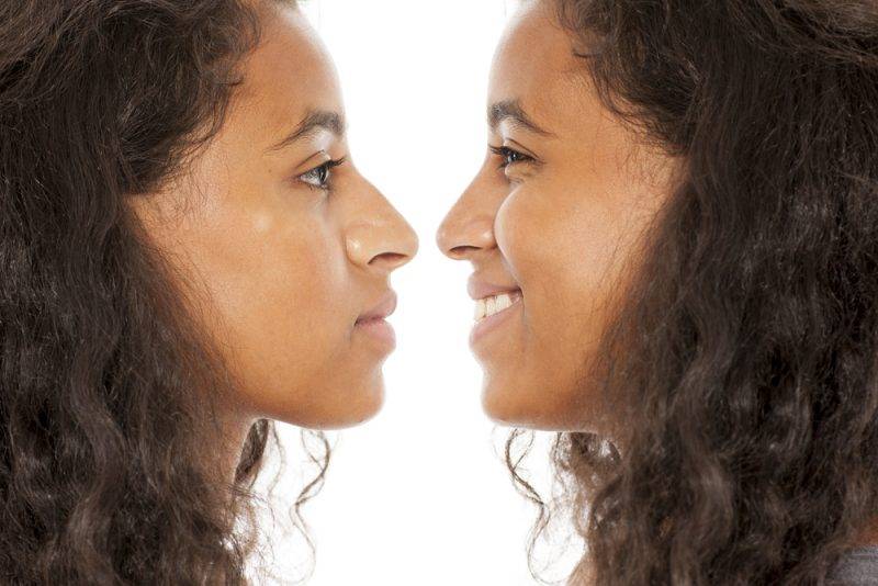 Wide Nose Rhinoplasty: A Complete Guide | Dr Frati Cosmetic Surgery